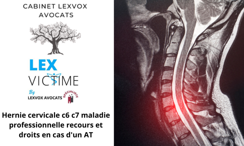Hernie Cervicale C6 C7 Maladie Professionnelle Recours Et Droits En Cas