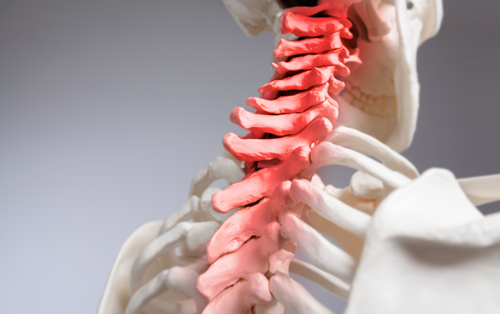 Hernie discale l4 l5 et douleur disque lombaire - Lexvox Medical